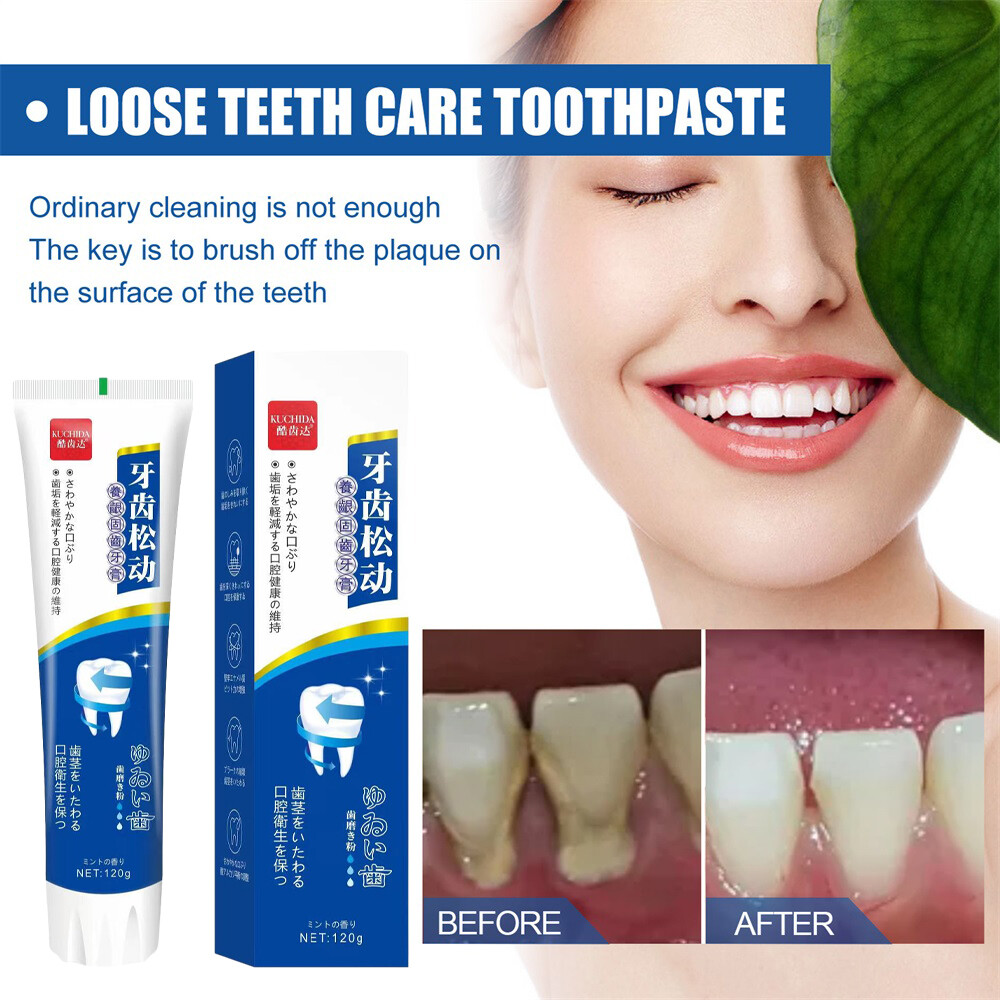 Loose Teeth Care Toothpaste Loose Tooth Repair for Gingivitis Treatment ...