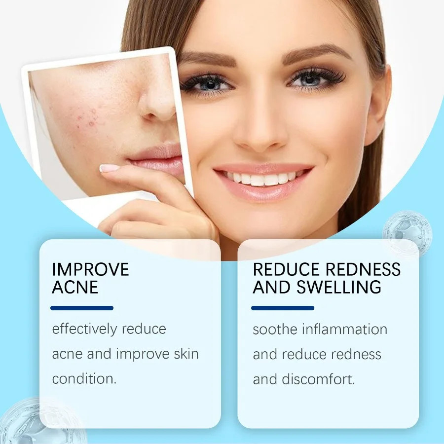 Houkea Retinol Gel Gently Cleanses Face Acne Care And Improves Skin Gel ...