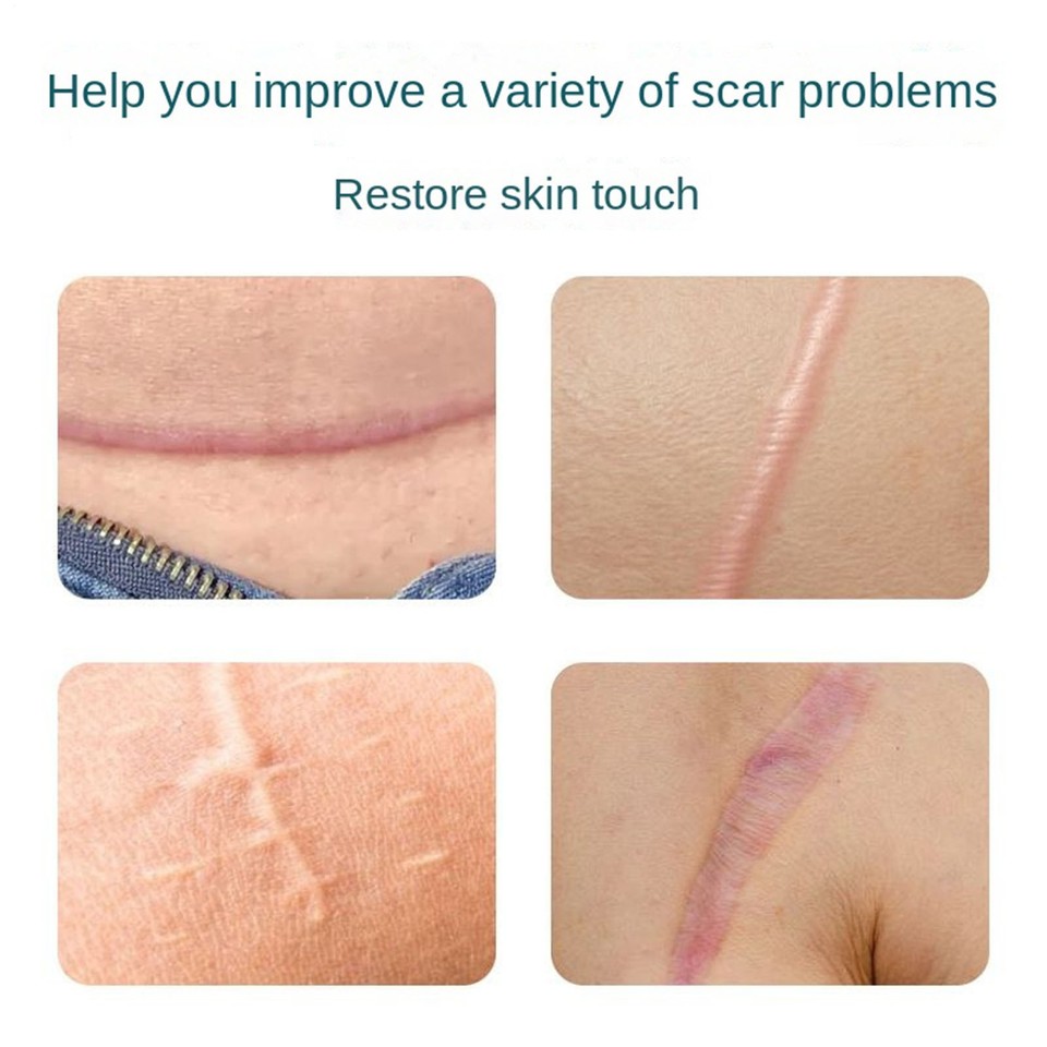 Scar Silicone Sheet Gel Patch Removal Skin Treatment Repair Wound Burn ...