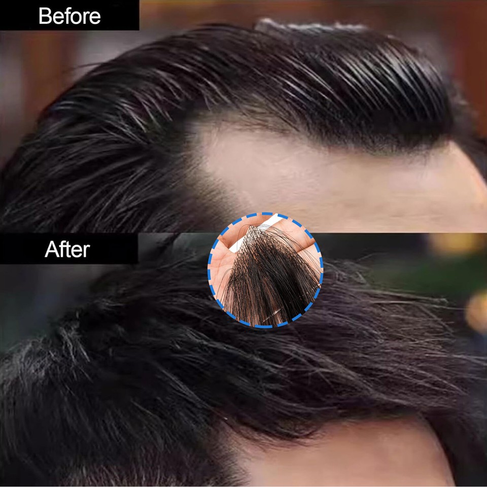 Front Hairline 100% Human Hair Patch Full Skin Base Cover-Up Topper ...