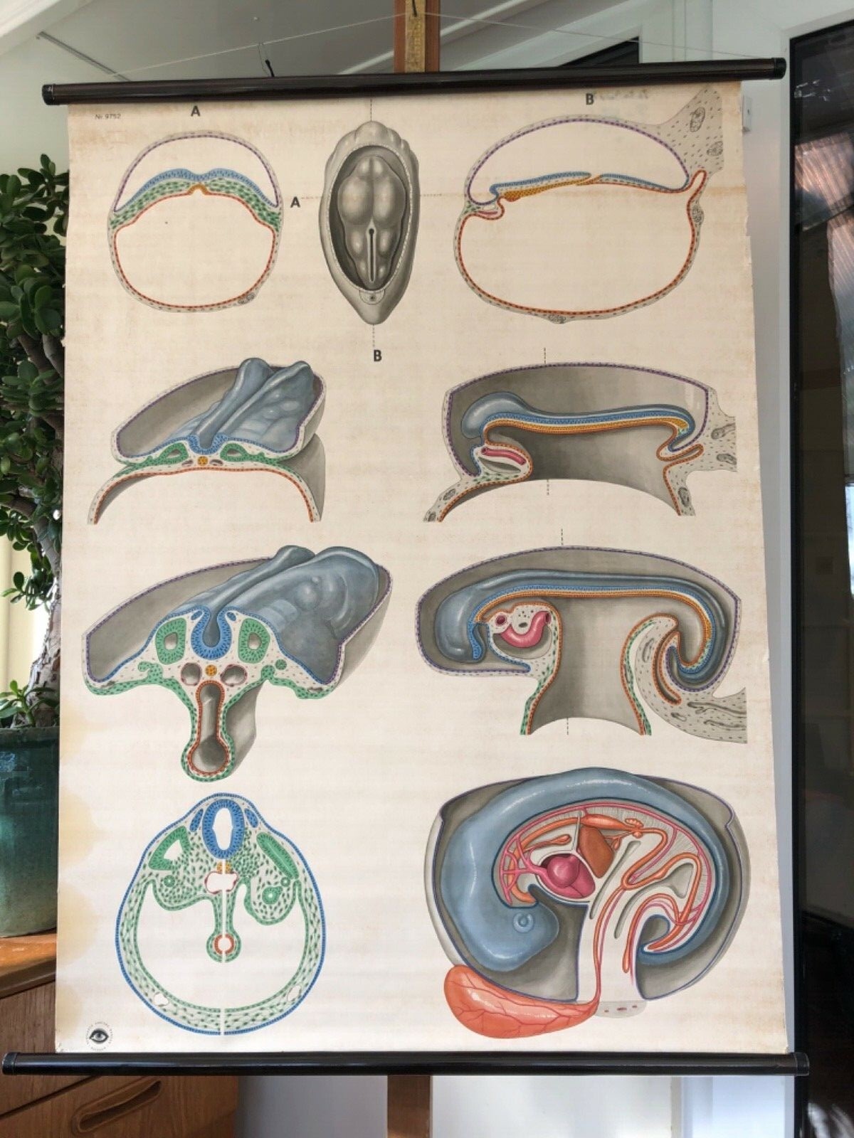 Vintage school chart EMBRYOLOGY midwifery poster ANATOMY educational ...