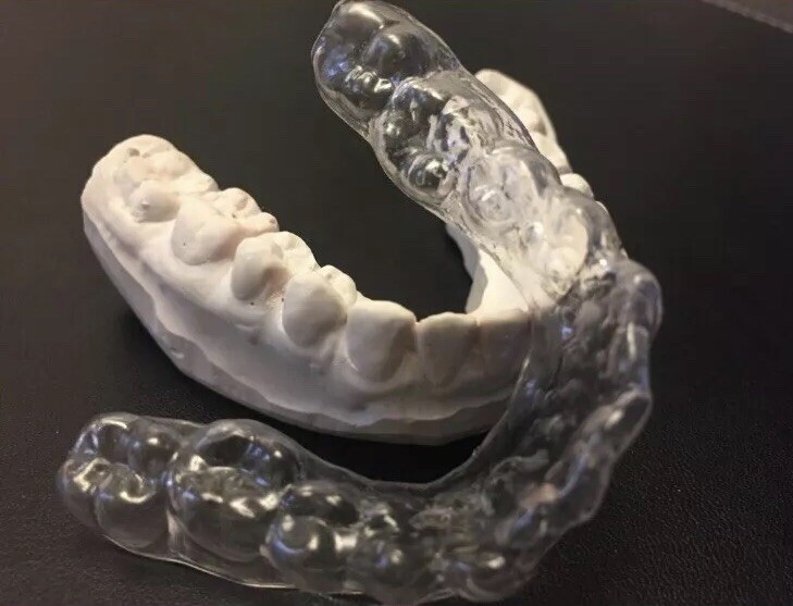 Custom Fit Dental Orthodontic Essix Retainer LOWER @Upper + Free ...