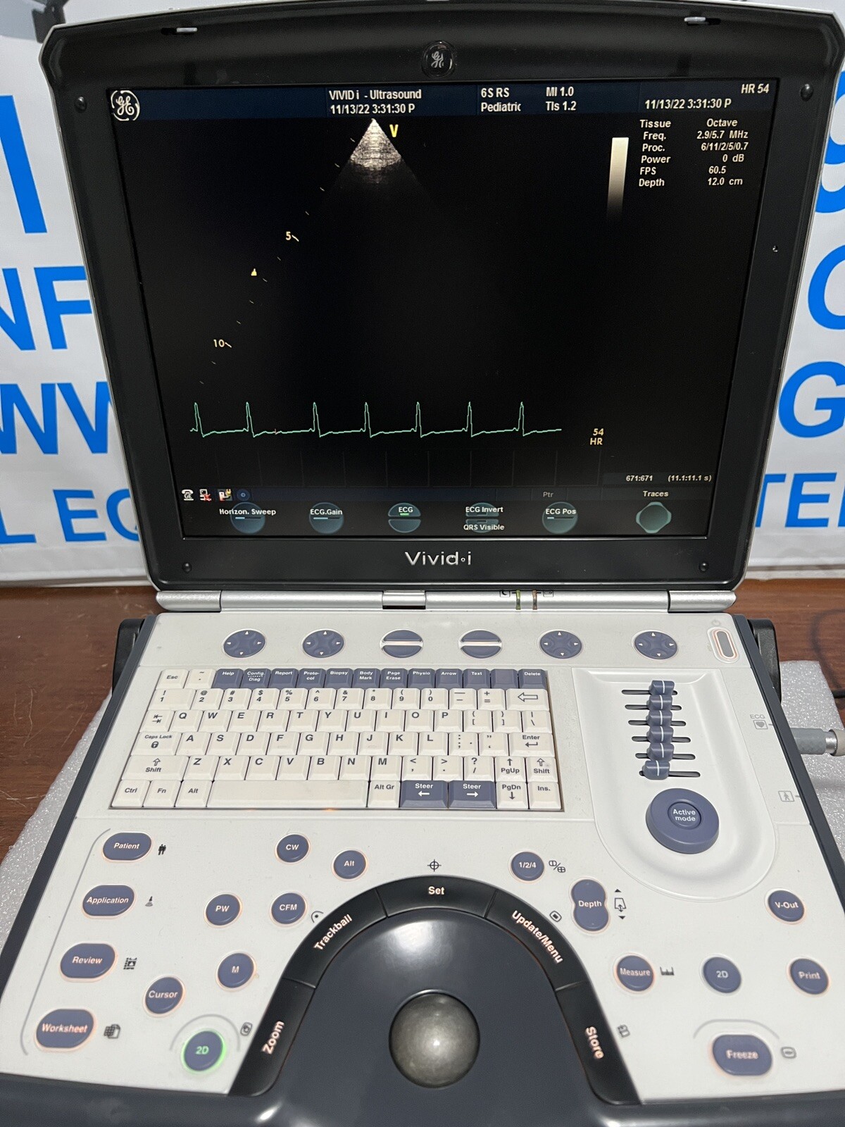 GE VIVID i Ultrasound with 6S-RS Cardiac Pediatric probes (READ THE ...