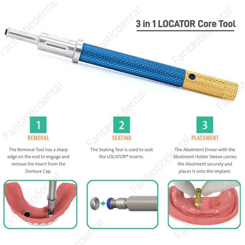 Dental Abutment Attachments Locator Inserts Retention Locator Core Tool ...