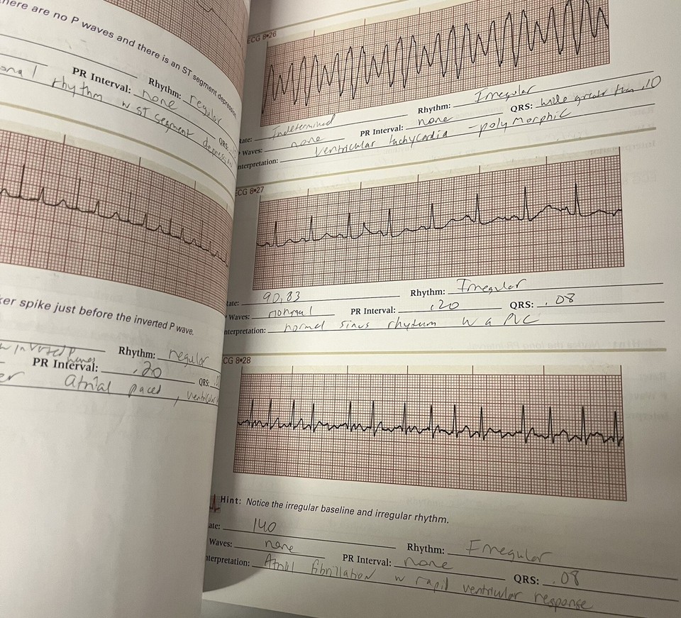 ECG Mastery : Improving Your ECG Interpretation Skills 2nd Ed. Shirley ...