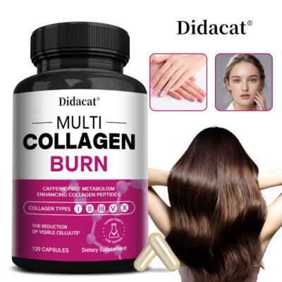Multi Collagen Burn Capsules for Weight Loss - Hydrolyzed Collagen ...