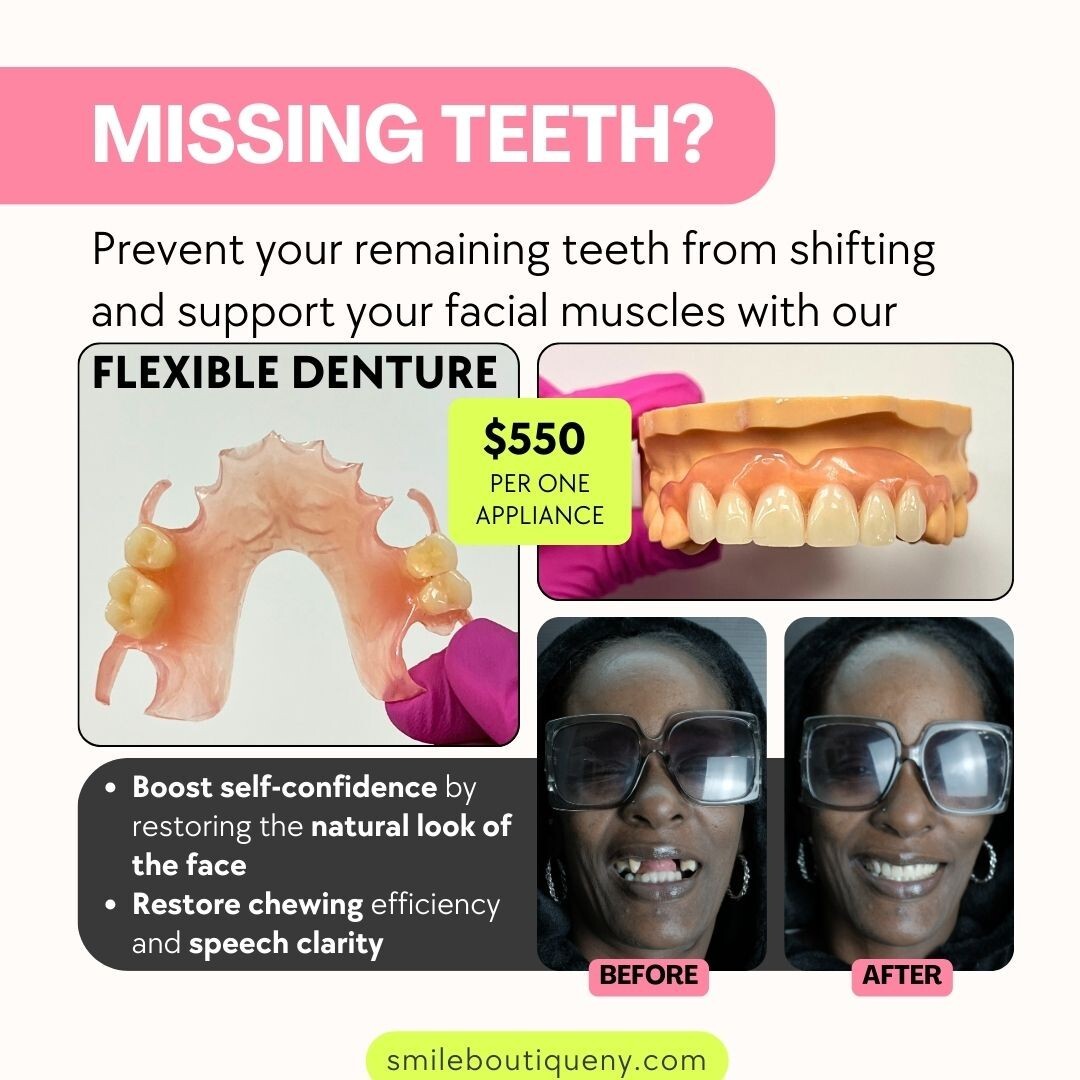 Tailor Your Smile: Dental Impression Kit for Dentures, Veneers and ...