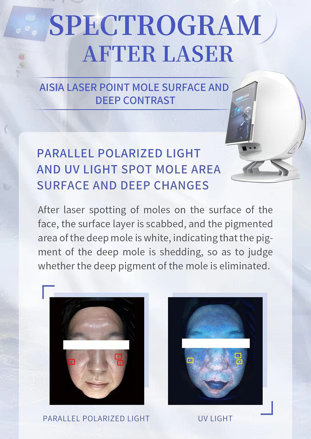 3D Digital Skin Analysis Machine Facial Skin Analyzer Pigment Wrinkle ...