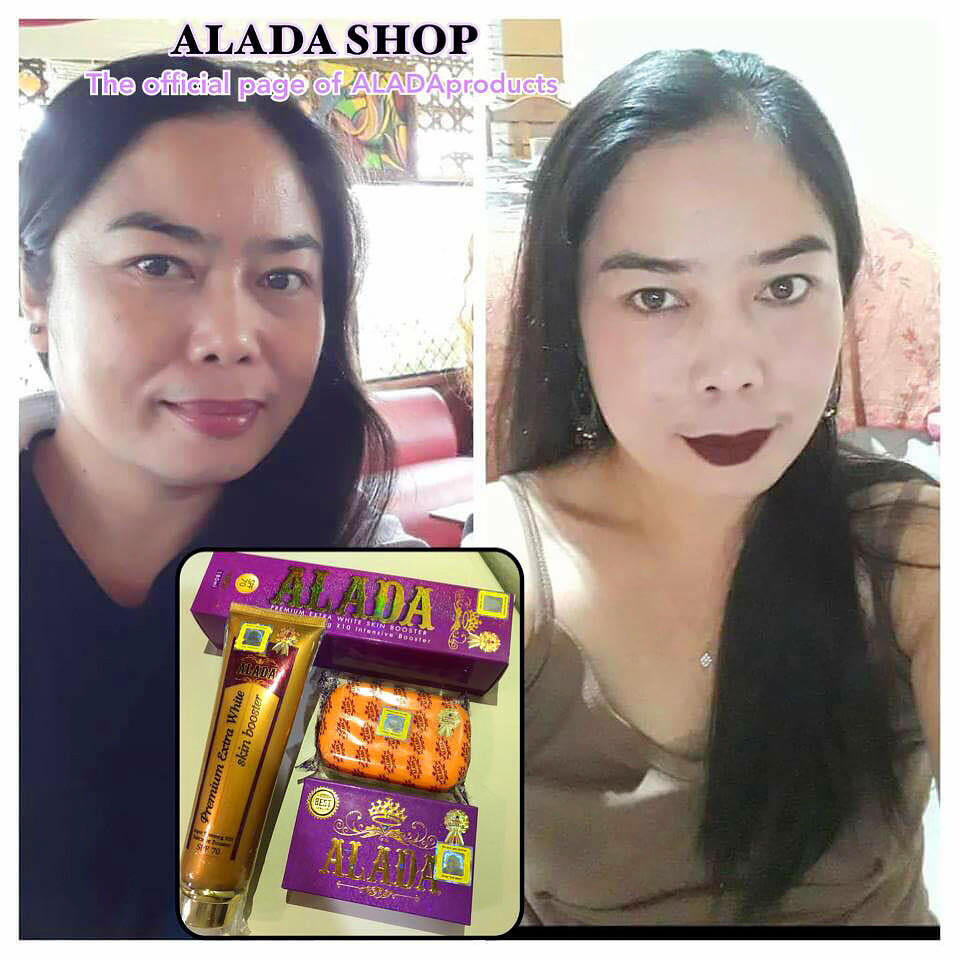 ALADA Super Fast Whitening Skin x10 Soap & Booster Lotion Set (USA 🇺🇸 ...
