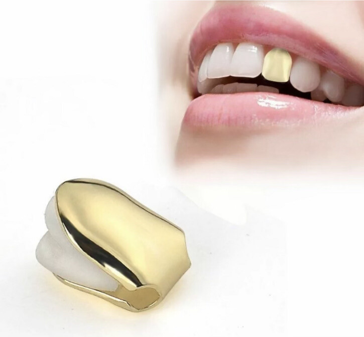 Single Gold Tooth