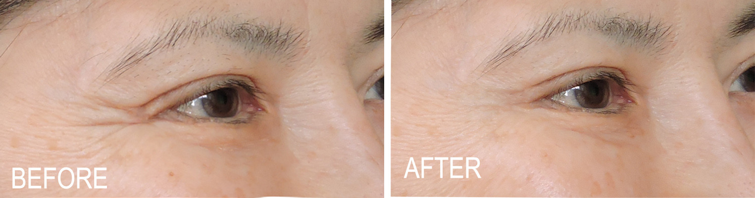 15 ml- DIY Argireline Peptide 100% Solution Serum Booster Add to Your ...