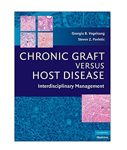 Chronic Graft Versus Host Disease: Interdisciplinary Management ...