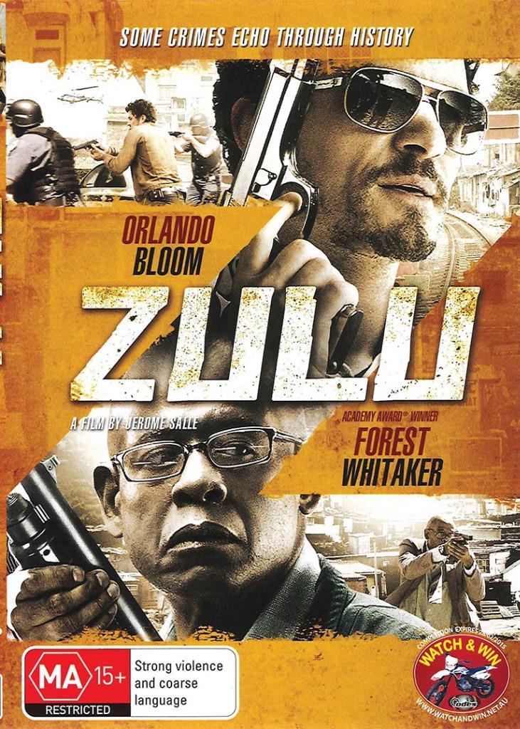 Boda Pedicura Y Zulú