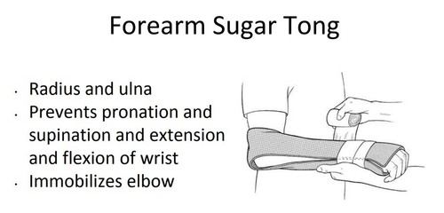 Fiberglass Sugar Tong - Reverse Tong Arm Splint Kit | Orthopedic Elbow ...