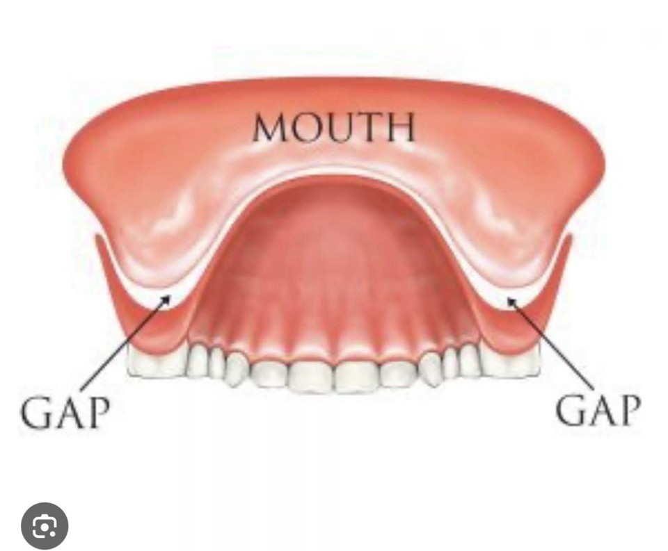 DIY Denture Reline Gum Material 4 Reusable Pink Strips Craft Dentures ...