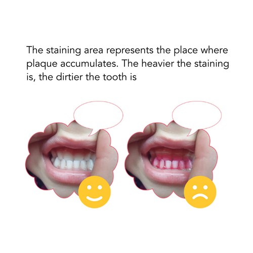 (Strawberry Flavor)200ml Plaque Disclosing Mouthwash Safety Fruity ...