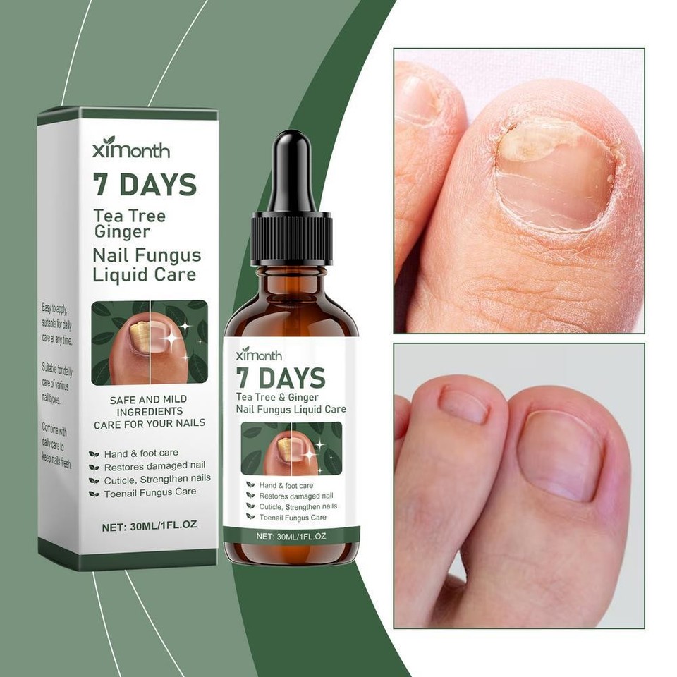 7Days Ginger & Tea Tree Nail Liquid Care,Growth Serum care Nourishing ...