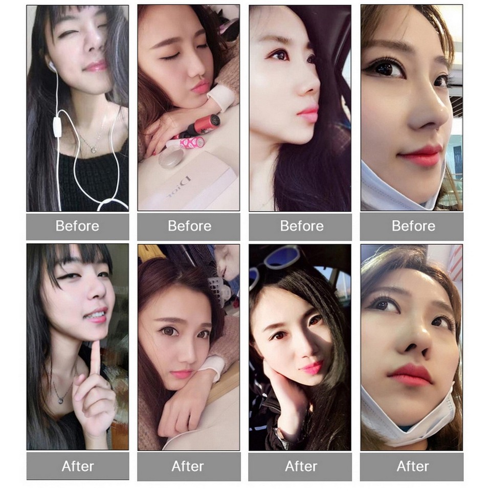 6 Pairs Invisible Nose Lifter 3-Size Comfortable Silicone Easy Install ...