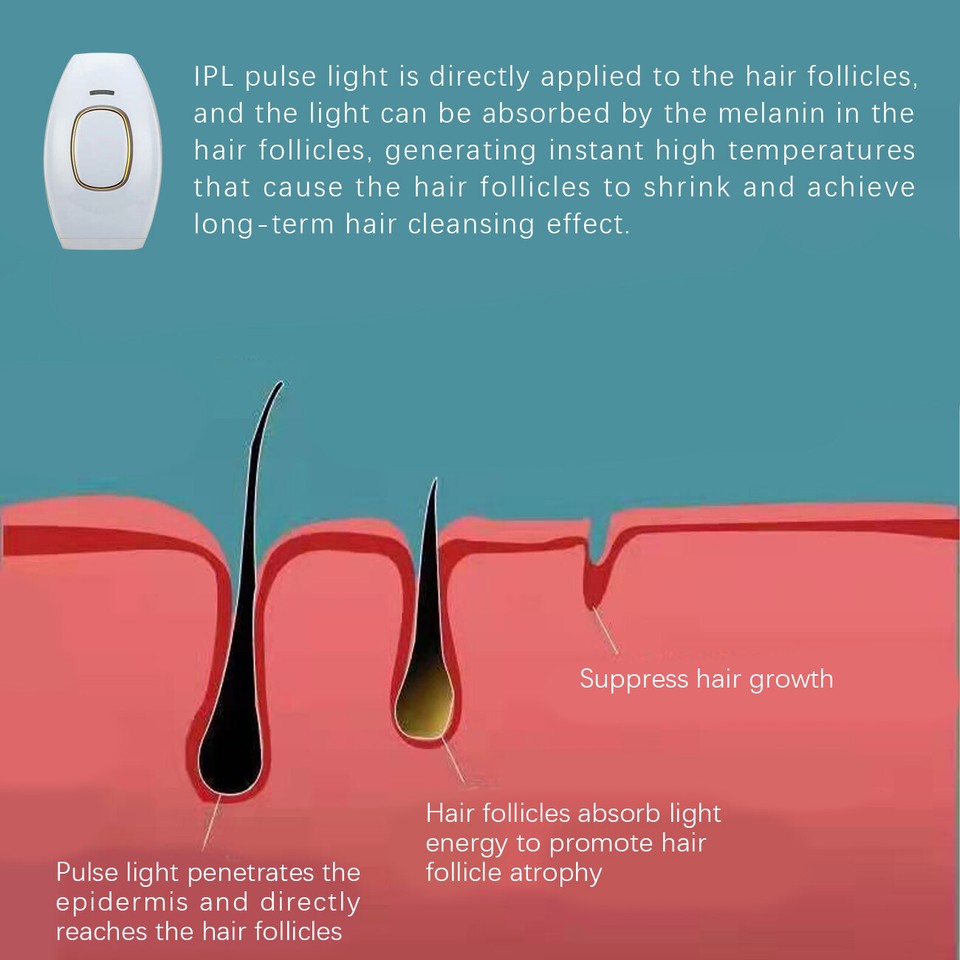 IPL Laser Hair removal skin rejuvenation Ultra skin Pro,leg,bikini zone ...