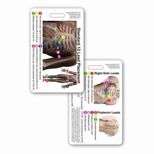 EKG 12 Lead Placement Vert Ref. Badge Card ID Pocket Guide Quick Cheat ...