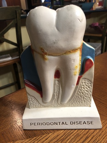 Dentist Tooth Counter Store Display 1950’s | eBay