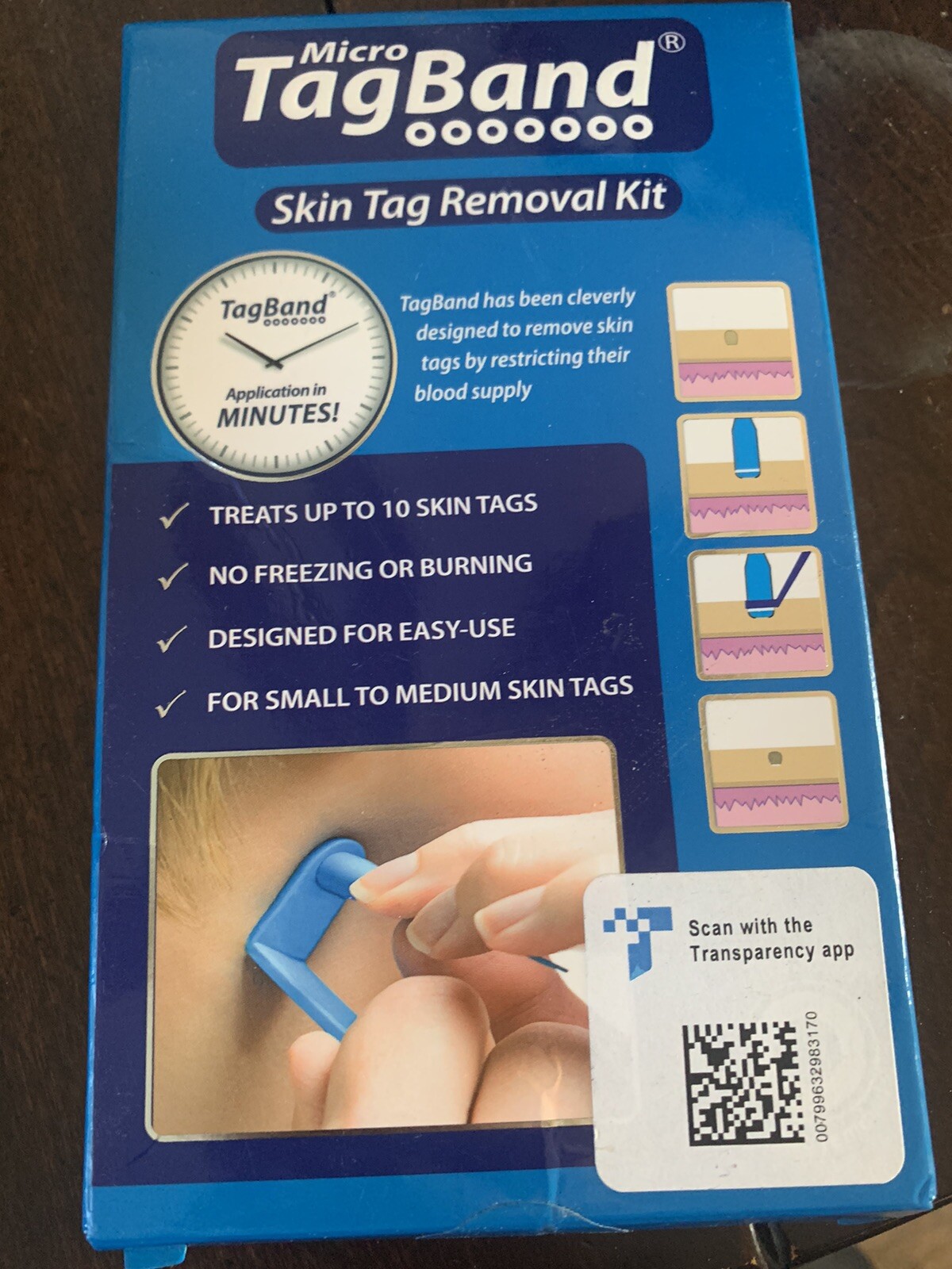 TagBand Small to Medium Skin Face Body Tag Remover Device Fast Skintag ...