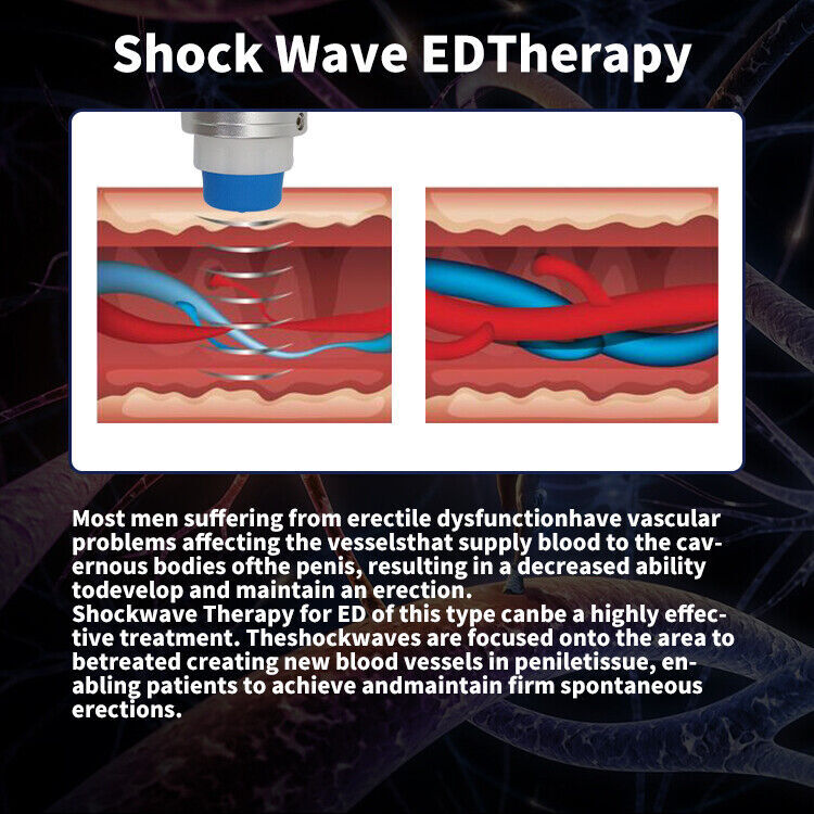 ED Treatment Touch Screen Shockwave Therapy Machine For Muscle Pain ...