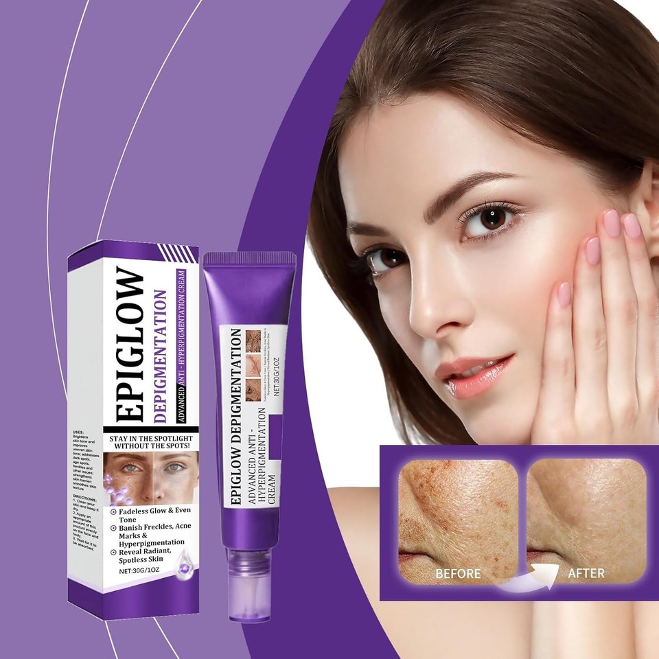 Pigmentation Removal Cream Anti-Hyperpigmentation Cream Skin Advanced ...