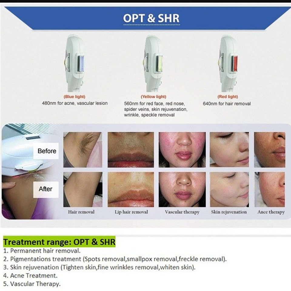 PRO IPL Elight OPT Laser Permanent Hair Removal RF Skin Care Salon ...