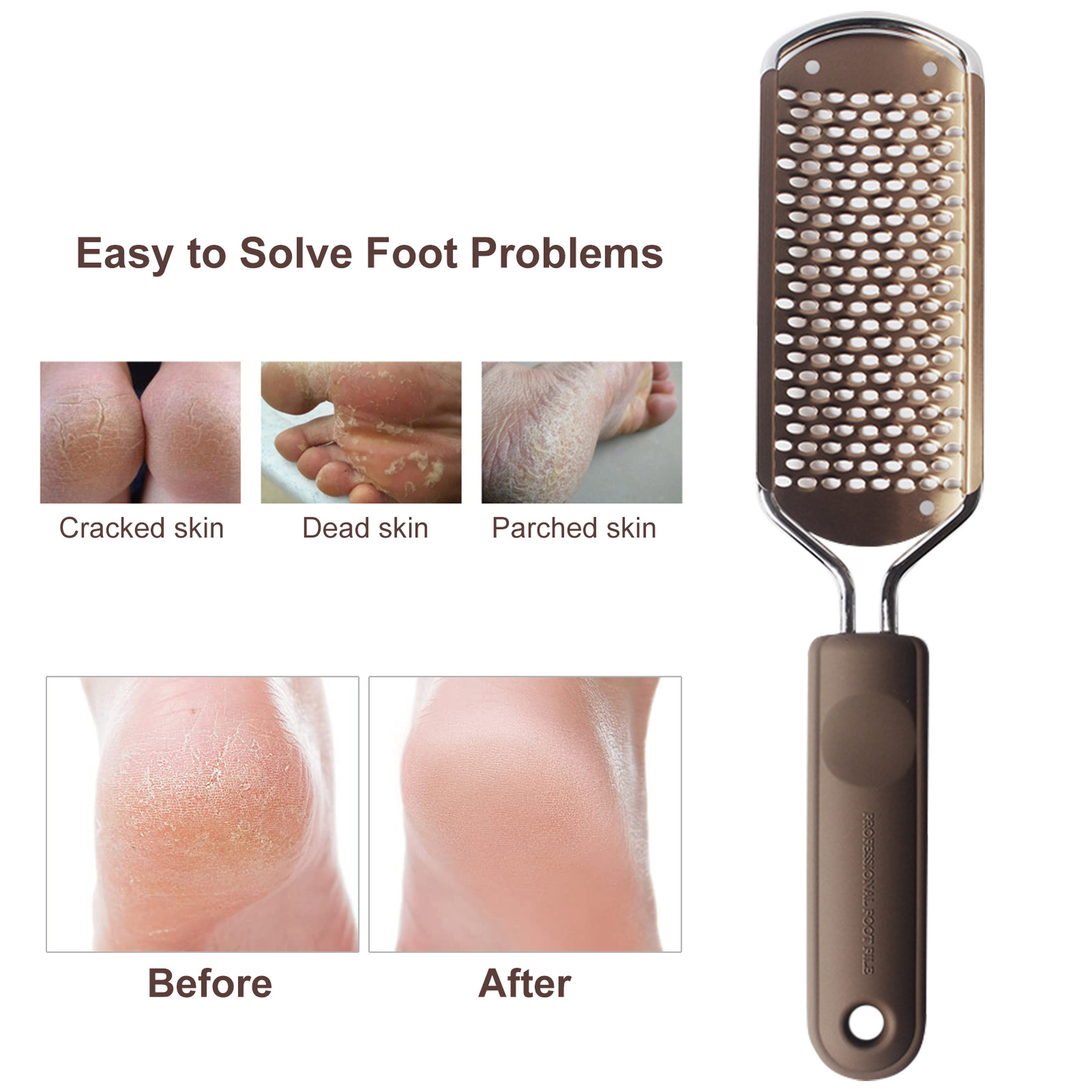 Foot Scrubber Anti-dust Portable Professional Foot Dead Skin Remover ...