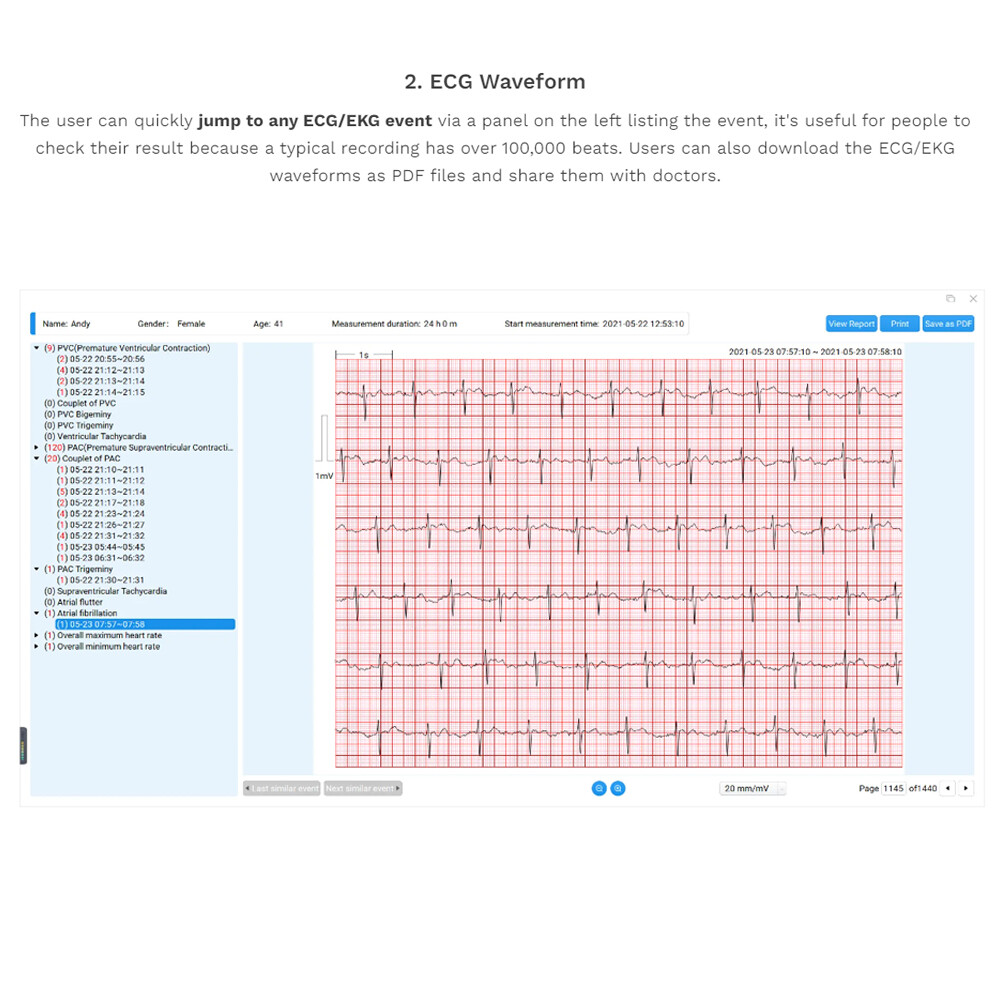24h Holter Monitor ECG Recording Detailed Reports by AI Analysis US ...