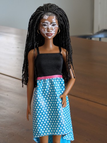 Ooak Repainted Barbie With Vitiligo Birth Mark | eBay