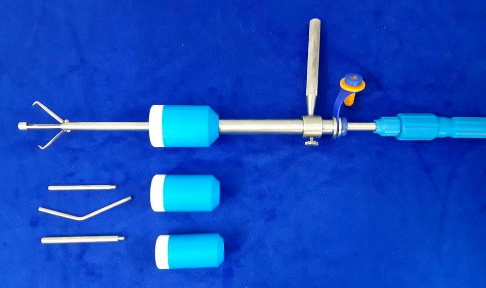 Laparoscopic hysterectomy (TLH) Mangeshikar Uterine Manipulator ...