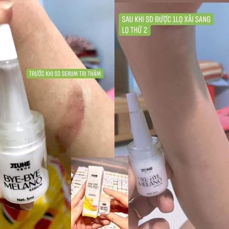 JIUHE Original ( EXP 10/2027)Bye-Bye Melano Serum ( 5ml ) | eBay