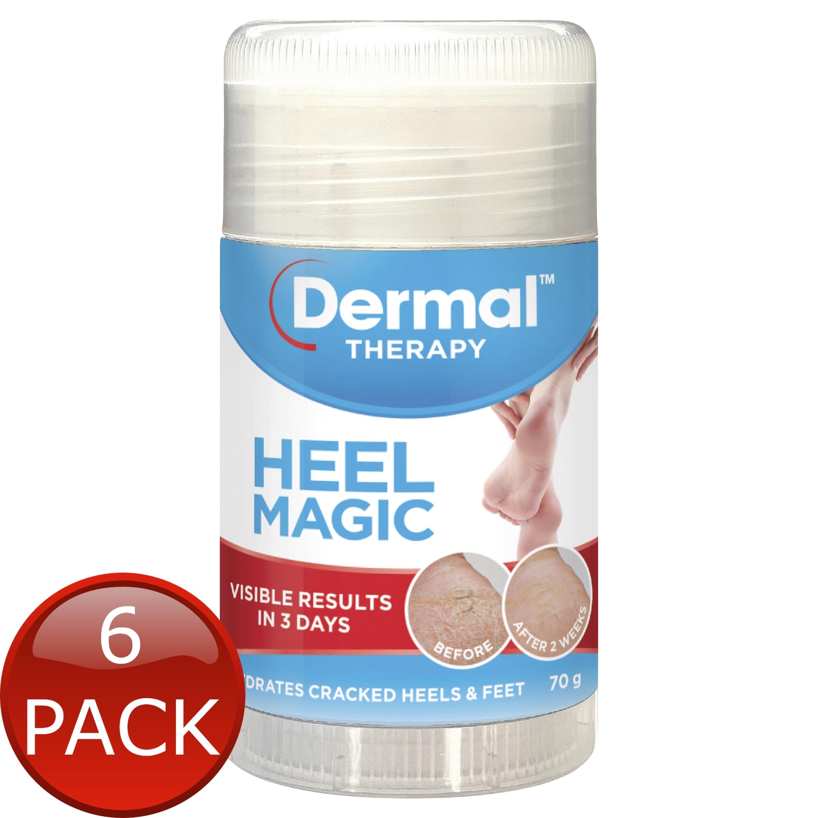 6 x Dermal Therapy Heel Magic Roll On 70G | eBay