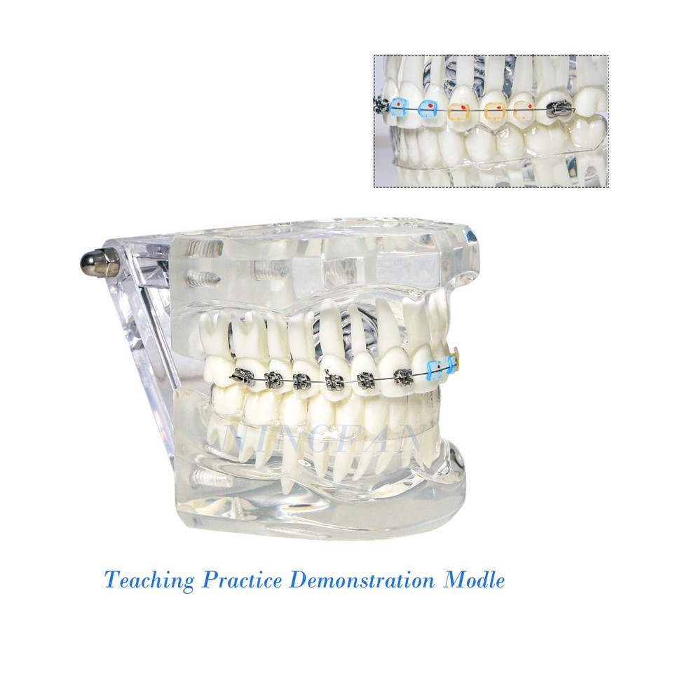 Dental Orthodontic Typodont Model For Teaching Practice Demonstration ...