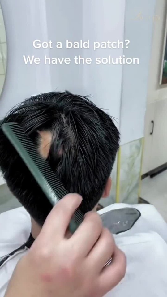 US Cover-up Tape Human Hair Patch Bald Spot Hairpiece Toupee For ...