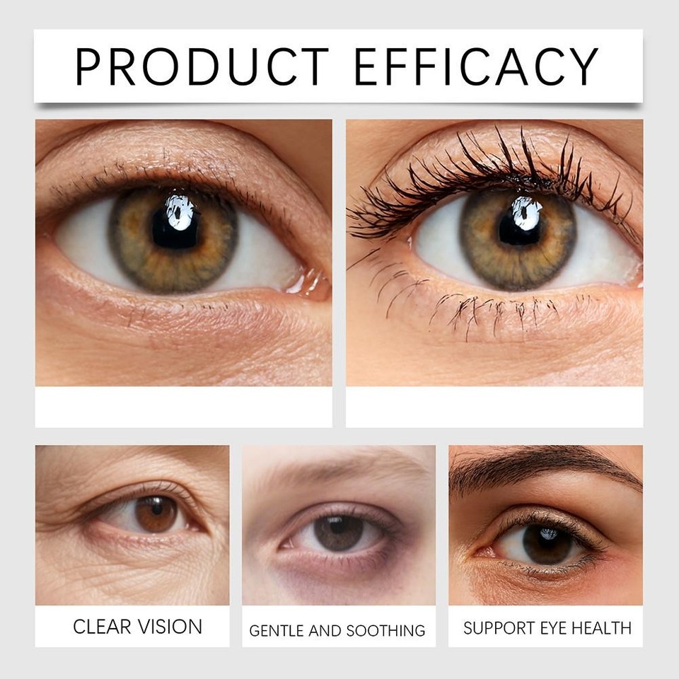 Eye Drops Relieves Eyes Discomfort Blurred Eyes Sore Eye Care Itchy ...