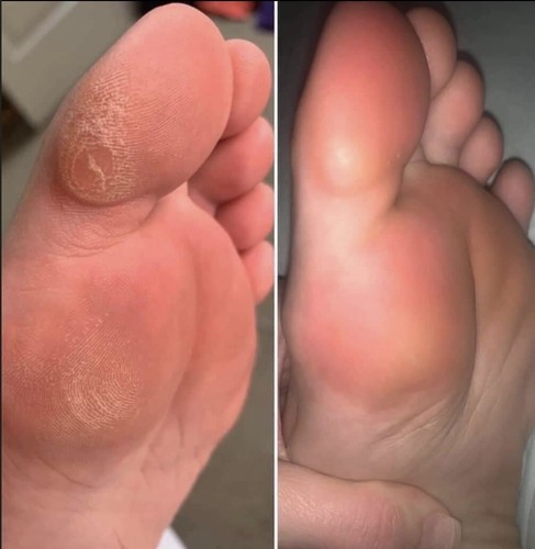 Nu Skin Epoch Sole Solution Foot Treatment - 01001988 | eBay