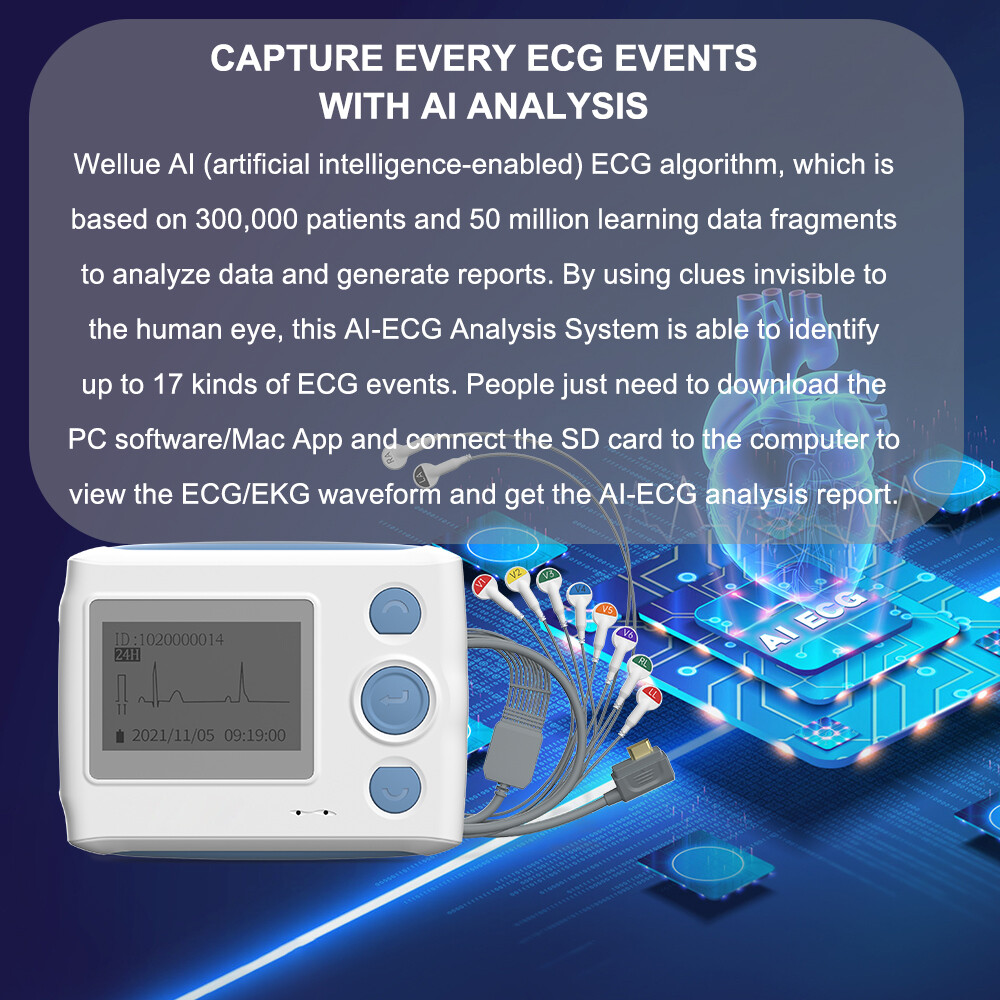 12 Lead Holter Monitor Recording 24h ECG and Heart Rate AI Analysis ...