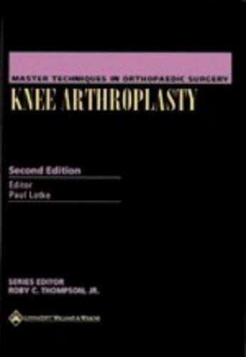 Master Techniques in Orthopaedic Surgery Ser.: Knee Arthroplasty by ...