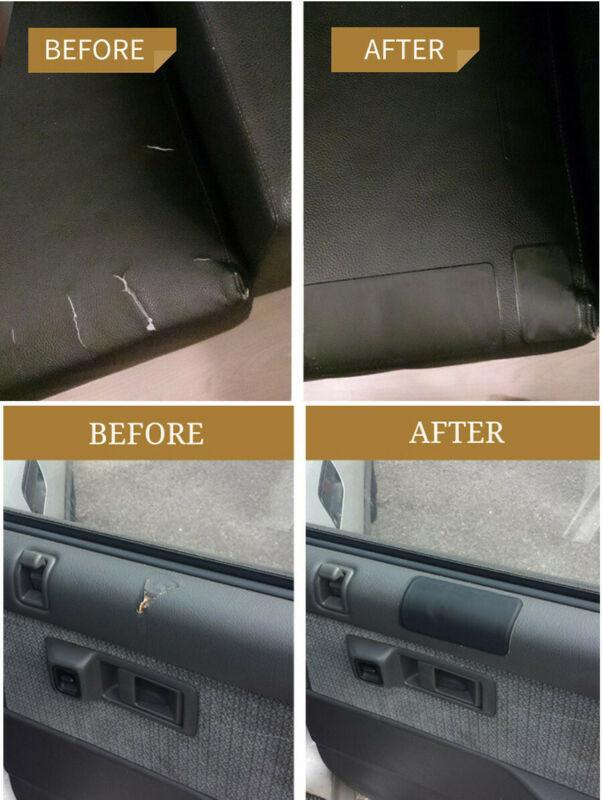 Leather&Vinyl Repair Patch For Car Seat Sofa Fix Holes Burns Gouges ...