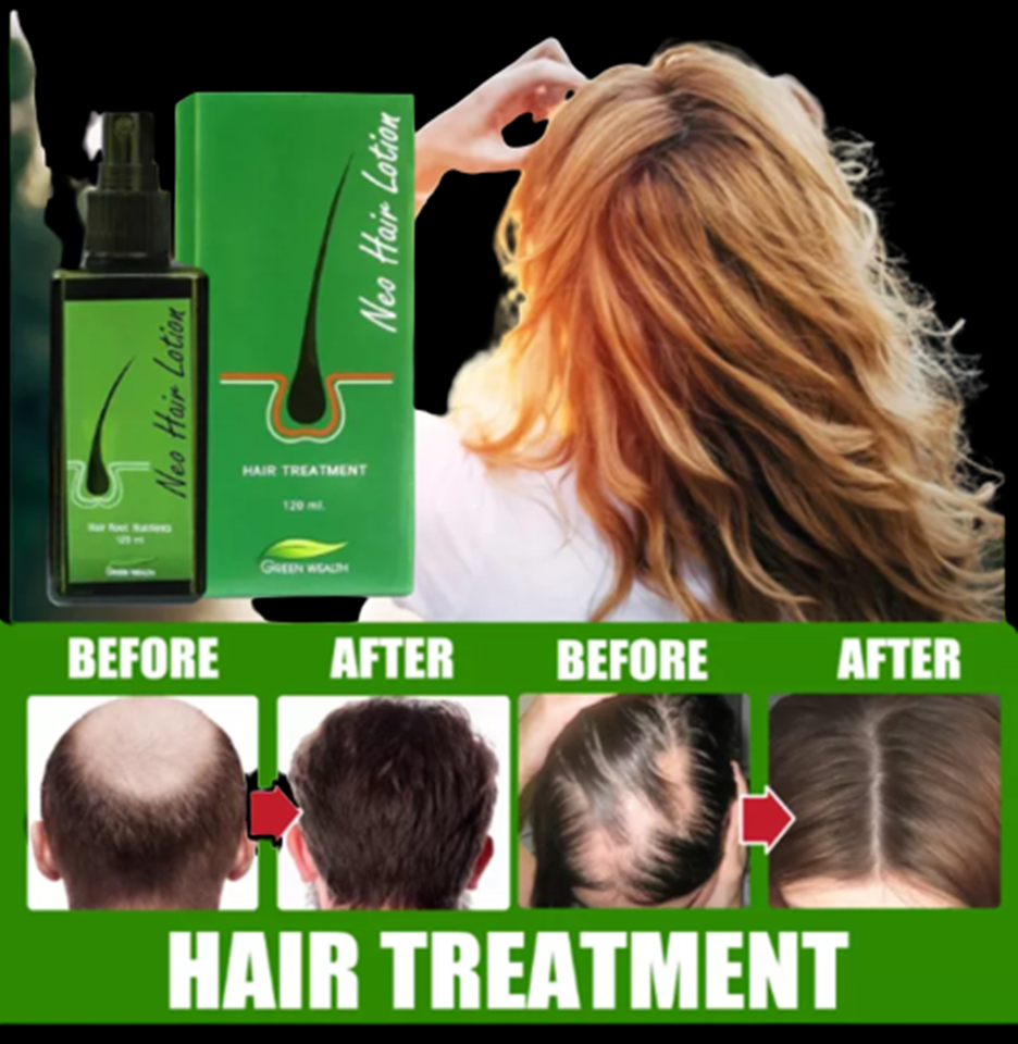 Neo Hair Lotion Hair Root Treatment Original Nutrients Longer Hair ...