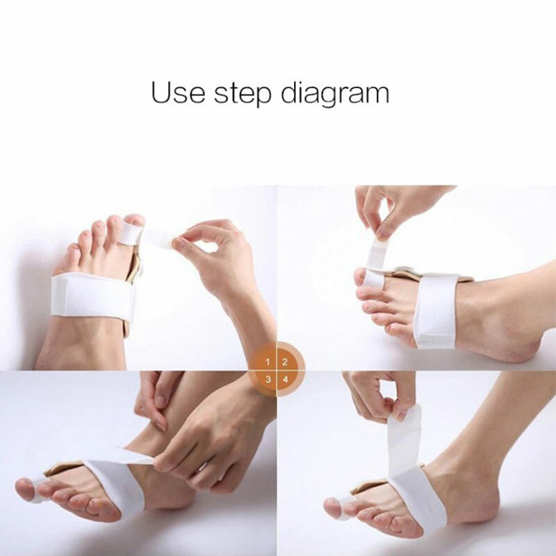 Toe Orthosis Bone Thumb Valgus Orthosis Unisex Day Night Toe Can Wear ...