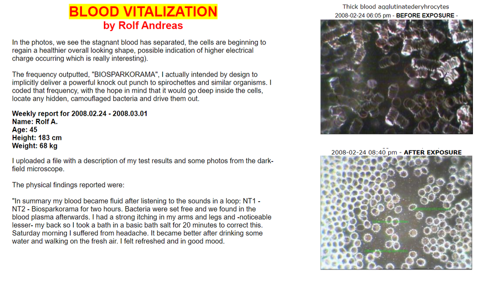 Best Frequencies for coils orgone radionics DIY QI scalar wave abha QI ...