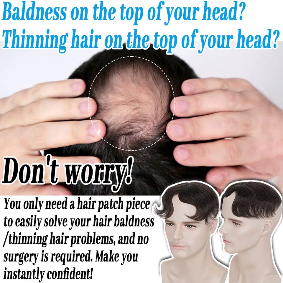Men's Remy Human Hair Patches Pieces Toupee for Top Head Hair Loss Thin ...