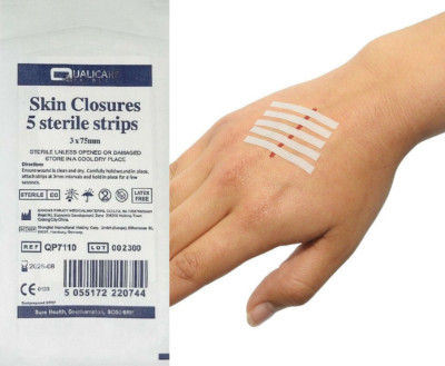 Qualicare 3mm x 75mm Adhesive Sterile Skin Wound Closure Strips Sutures ...