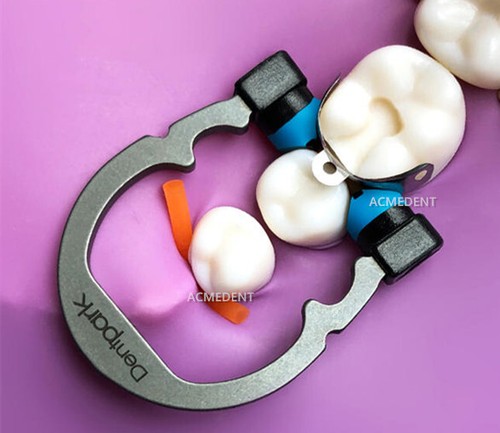 20-Pcs Dental Titanium Alloy Ring Matrix Clamp Clip Fits Garrison ...
