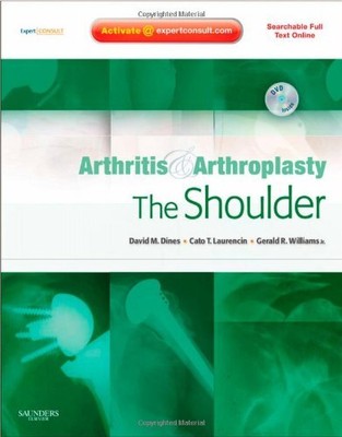 ARTHRITIS AND ARTHROPLASTY: THE SHOULDER: EXPERT CONSULT - By Dines ...
