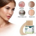 Professional Silicone Scar Sheets Silicone Scar Tape Roll 1.6” X 120 ...
